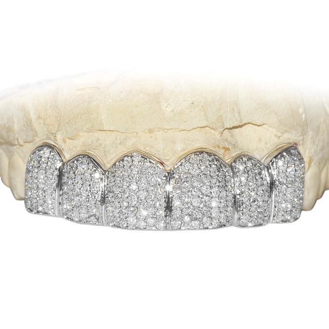 Diamond Grillz – Johnny Dang & Co