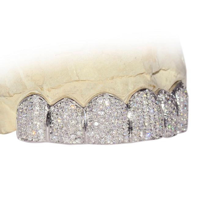 Diamond Grillz – Johnny Dang & Co