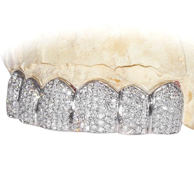 Diamond Grillz – Johnny Dang & Co