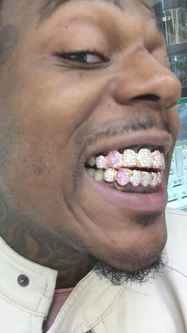 Diamond Grillz – Johnny Dang & Co