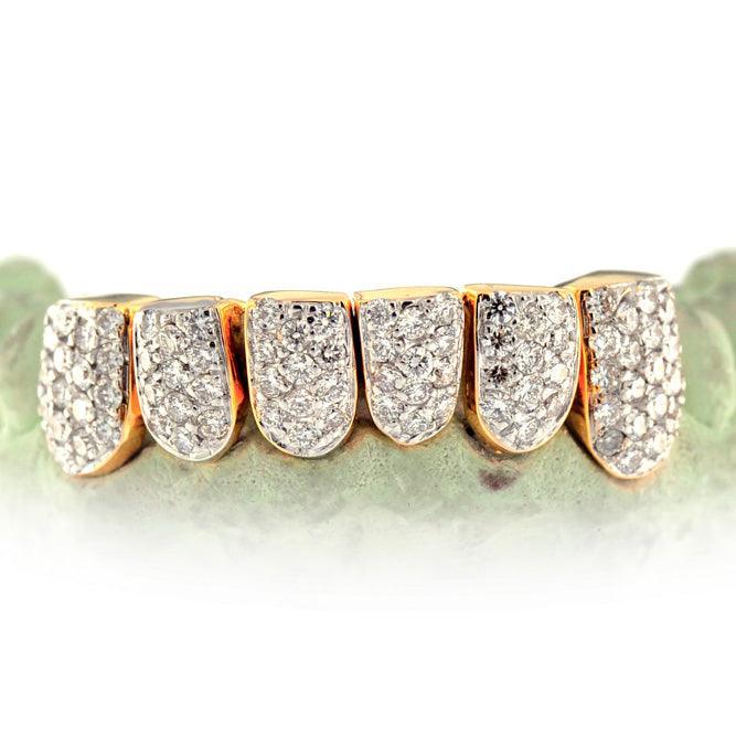 Gold and Diamond Permanentz – Johnny Dang & Co