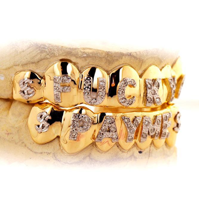 Silver Grillz – Johnny Dang & Co