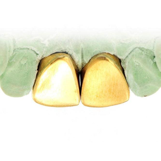 22KT Permanent Slugs – Johnny Dang & Co